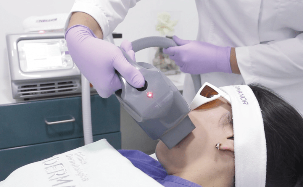 Excilite u – Láser Excímer (DEKA) – Dermanor